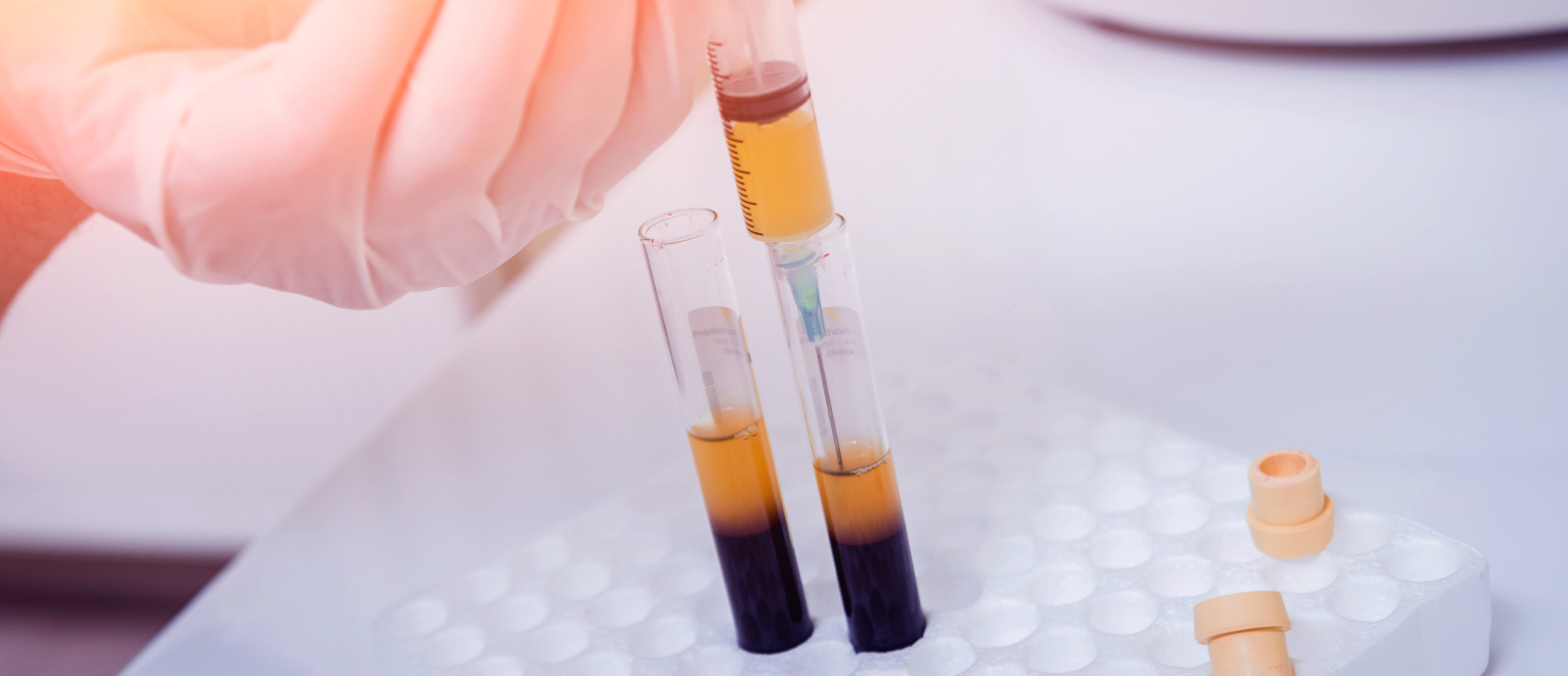 Platelet Rich Plasma (PRP) | Hair & Regenerative Plasma Therapy | Long ...